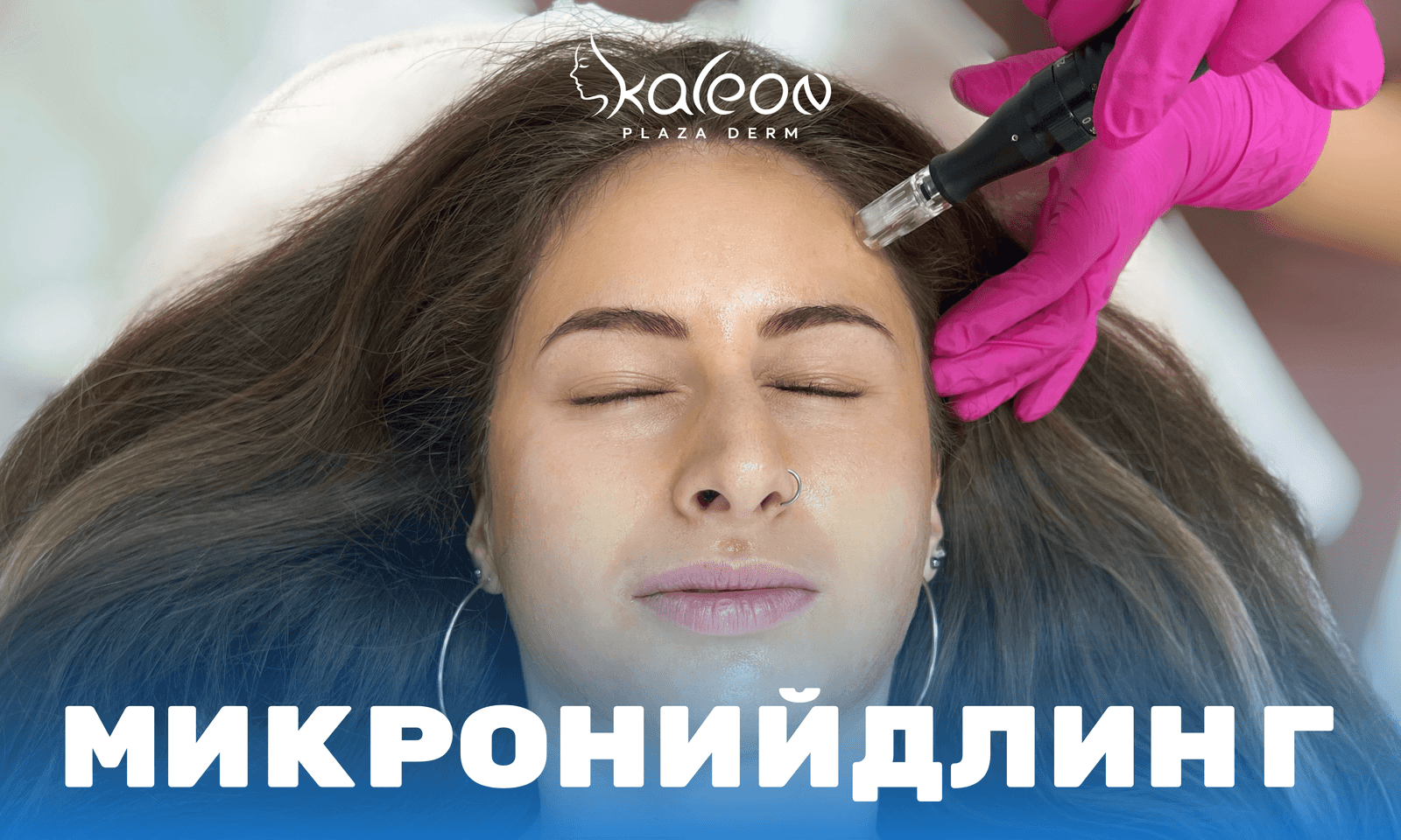 Микронидлинг - терапия за обновяване и подмладяване на кожата - Kaleon ...